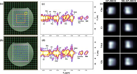 Figure 3 From Multi Echo Based Echo Planar Imaging Using A Mri Scanner