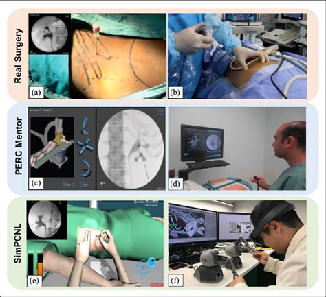 Table 1 From Augmented Reality Driven Medical Simulation Platform For Percutaneous