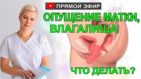 Опущение матки и стенок влагалища что делать Врач Екатерина Волкова Youtube
