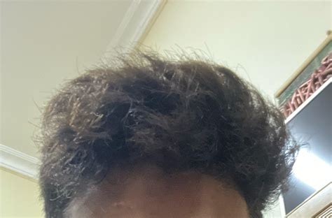 Scalp Visible After Oilingis It Balding Or Thinningthe Last 2 Photos Are On Application Of Oil