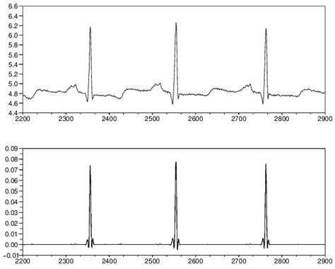 Ecg Signal And Its Indicator Signal Bottom For R Peak Detection Download Scientific Diagram