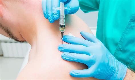 Trigger Point Injections TPI Remedy Pain Solutions Orthopedists Pain Management Specialists