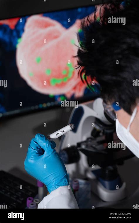 Blood Tests To Detect Sexually Transmitted Diseases Or STDs Hepatitis B And C Syphilis HIV