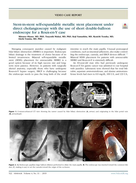 Pdf Stent In Stent Self Expandable Metallic Stent Placement Under Direct Cholangioscopy With