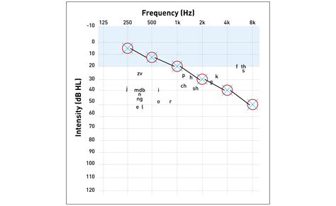 A Simple Guide To Understanding An Audiogram