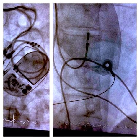 Drnabil Paktins Journal Of Cardiovascular Medicine Blog ژورنال قلب و رگ دکتور نبــیل