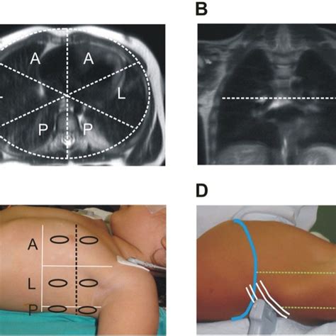 Chest Segmentation Of Mri Lus Image A The Axial Mri Cuts Were Download Scientific Diagram