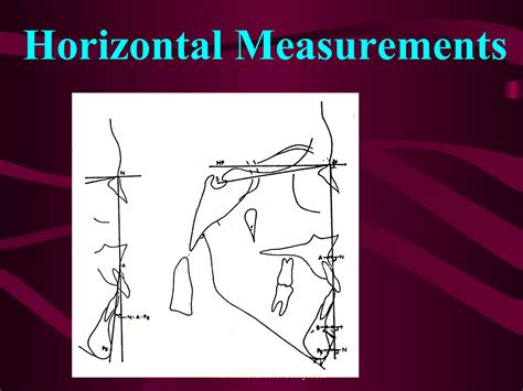 COGS Analysis Cephelometrics For Orthognathic Surgery Fixed Orthodontics Courses India PPT