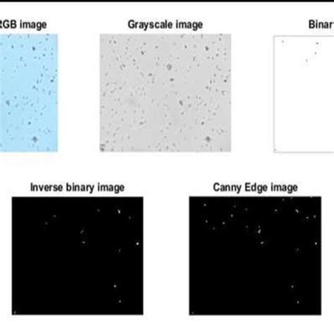 Slide Sample Analyses Microscopically Shows Positive Agglutination Download Scientific Diagram