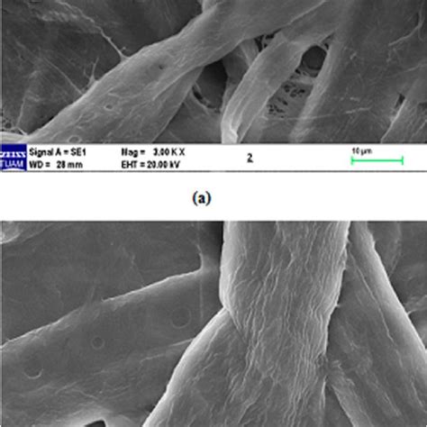 Sem Of The New Membranes A Cellulose B 5 25 W V Download