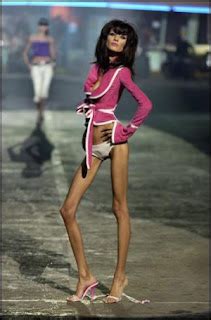 Be Barbie Anorexia Nervosa