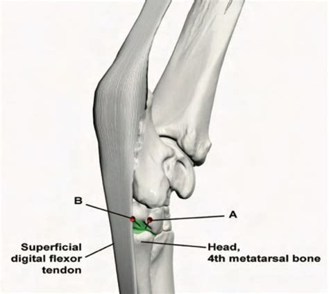 Intertarsal Joint