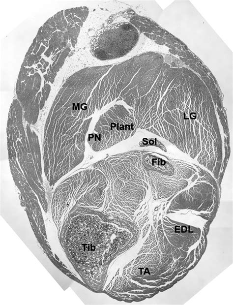 10 The Muscles Of The Lower Hind Limb In Cross Section In This Image
