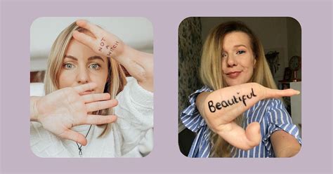 The Witches Movie People With Limb Difference Respond