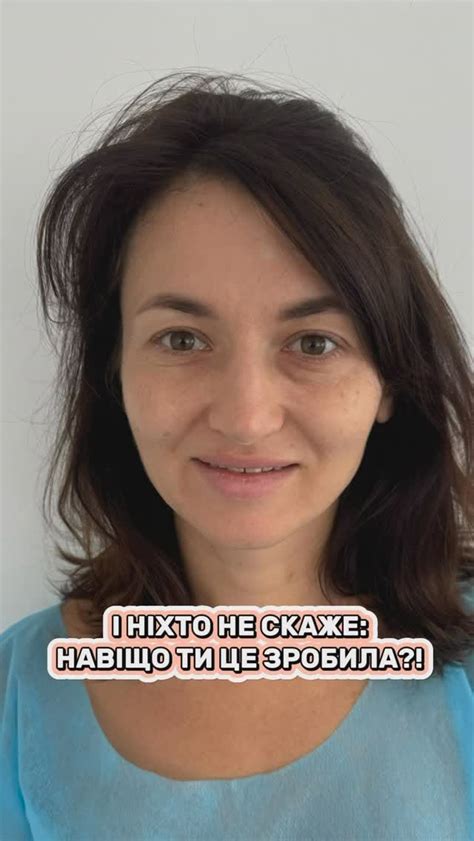 ПЛАСТИЧНИЙ ХІРУРГ • КИЇВ • Тетяна Побережна Dr Tetiana Poberezhna • Instagram Photos And Videos