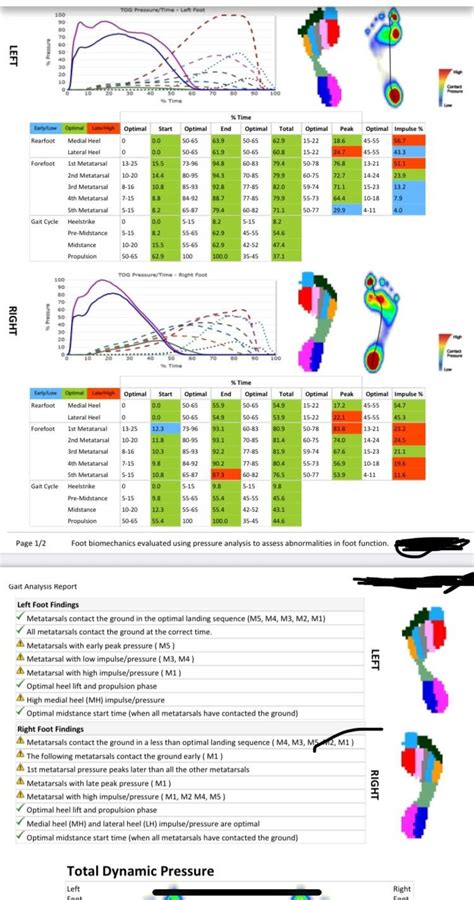 Can Anyone Please Help To Interpret My Foot Scan R Runningshoegeeks