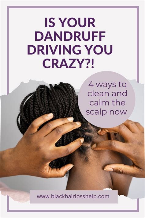 Ways To Treat An Itchy Scalp Itchy Scalp Causes Help Hair Loss How To Treat Dandruff