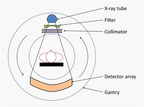 Components Of Ct Scan Free Transparent Clipart ClipartKey