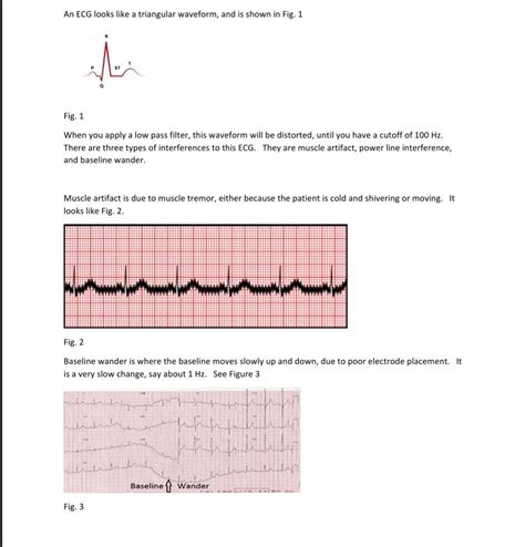 solved an ecg looks like a triangular waveform and is shown