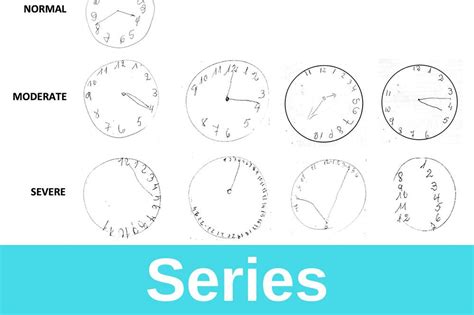 Clock Drawing Test Numbers Outside Circle At George Tarenorerer Blog