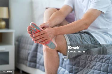 관절 질환 할로 발거스 발바닥 근막염 남자의 다리가 아파 발에 통증 족저 근막염에 대한 스톡 사진 및 기타 이미지 족저