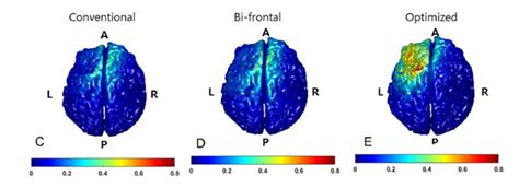 같은 행동만 반복하는 ‘최소의식상태 환자··· ‘이 치료로 회복