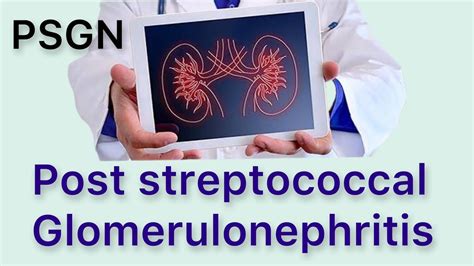Poststreptococcal Glomerulonephritis Labs At Cecil Messer Blog