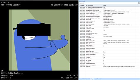 dicom file processing mr
