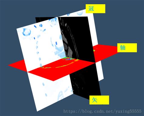 Vtk中三个切片方向展示vtk 视图中获取切片三个方位的位置 Csdn博客
