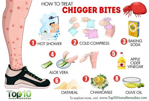 Pin On Health