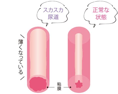 【尿漏れの原因は？】人に聞けない尿トラブル、専門医に聞いてみました！ 美st Online