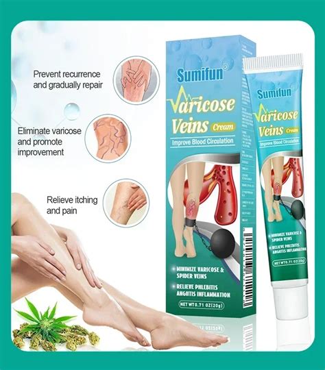 Лечение Варикозного расширения вен эффективное облегчение варикозного расширения вен облегчение