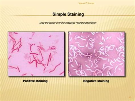 Staining Techniques Bacteria Pptx