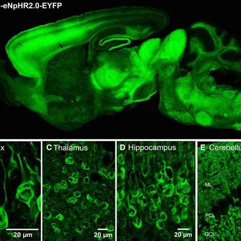 Expression Of Enphr20 In Thy1 Enphr20 Line 4 Transgenic Mouse Brain Download Scientific