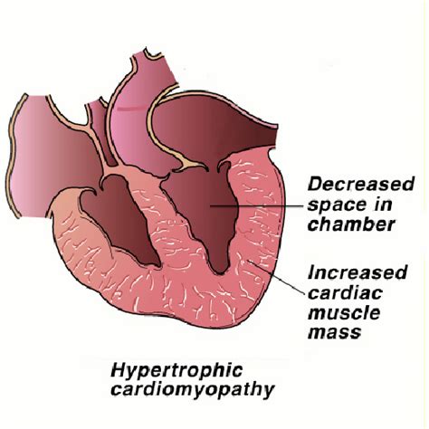 Hyperthyroidism In Cats At Home Veterinary