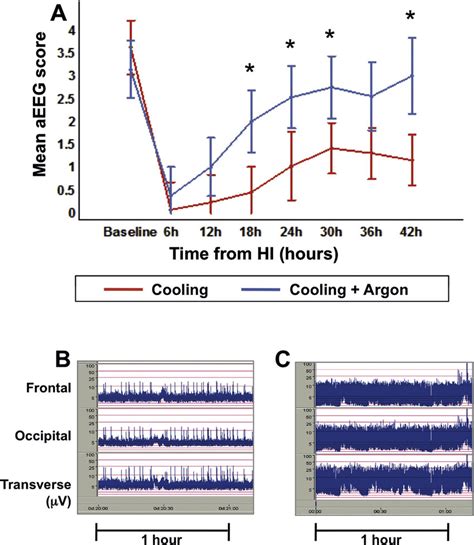 Amplitude Integrated Electroencephalogram AEEG The Group Mean Hourly Download Scientific