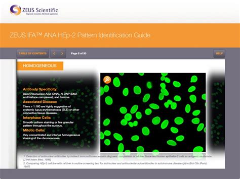 Zeus Ifa Digital Ana Hep 2 Cell Pattern Identification Guide Hd By Zeus