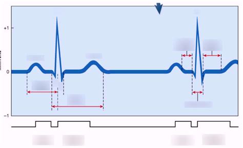 Labeling Ecg Strip Diagram Quizlet