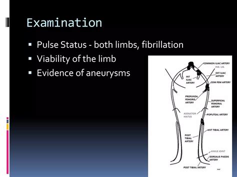 Acute Limb Ischaemia Usjp 2020 Pptx