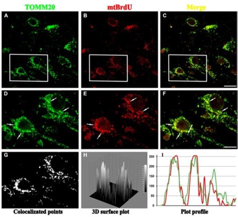 Confocal Microscopy Of Mature Hippocampal Neuronal Cult Open I