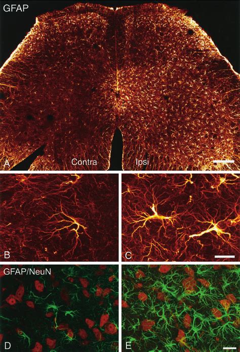 Confocal Images Showing The Increase In The Astrocyte Marker Gfap In Download Scientific