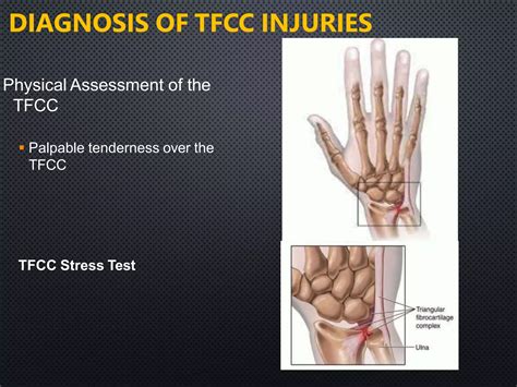 The Distal Radioulnar Joint And Tfcc Pptx