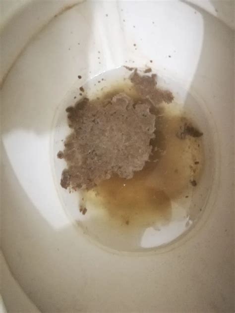 Wet Poop Explosion Fart