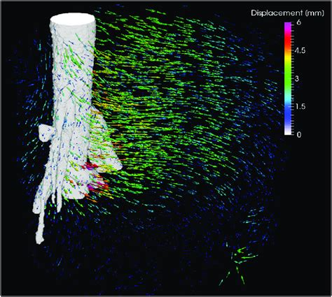 Soil Matrix Displacement Field Caused By The Growth Of The Dandelion