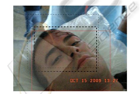 Face Detection Result Human Annotated Skin Facedetect Skin Download Scientific