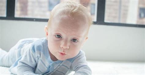 Risiko Autisme Bisa Dikurangi Dengan Terapi Lebih Dini