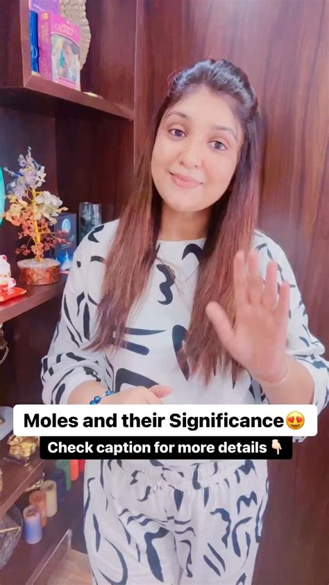 Birthmark Meanings What Does Your Birthmark Say About You Artofit