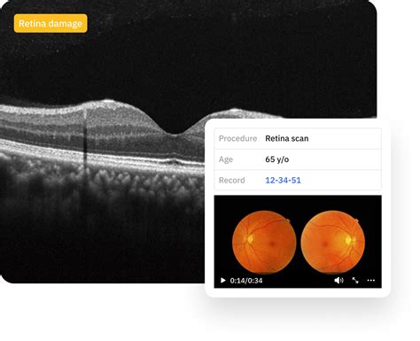 medical data annotation and labeling tool labelbox