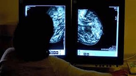 Computer Failure Caused Deaths Post Courier