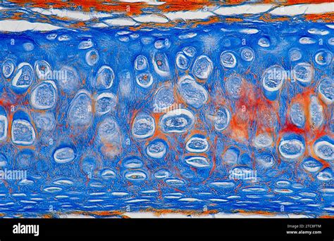 Ear Section Showing Elastic Cartilage Tissue With Chondrocytes Optical Microscope